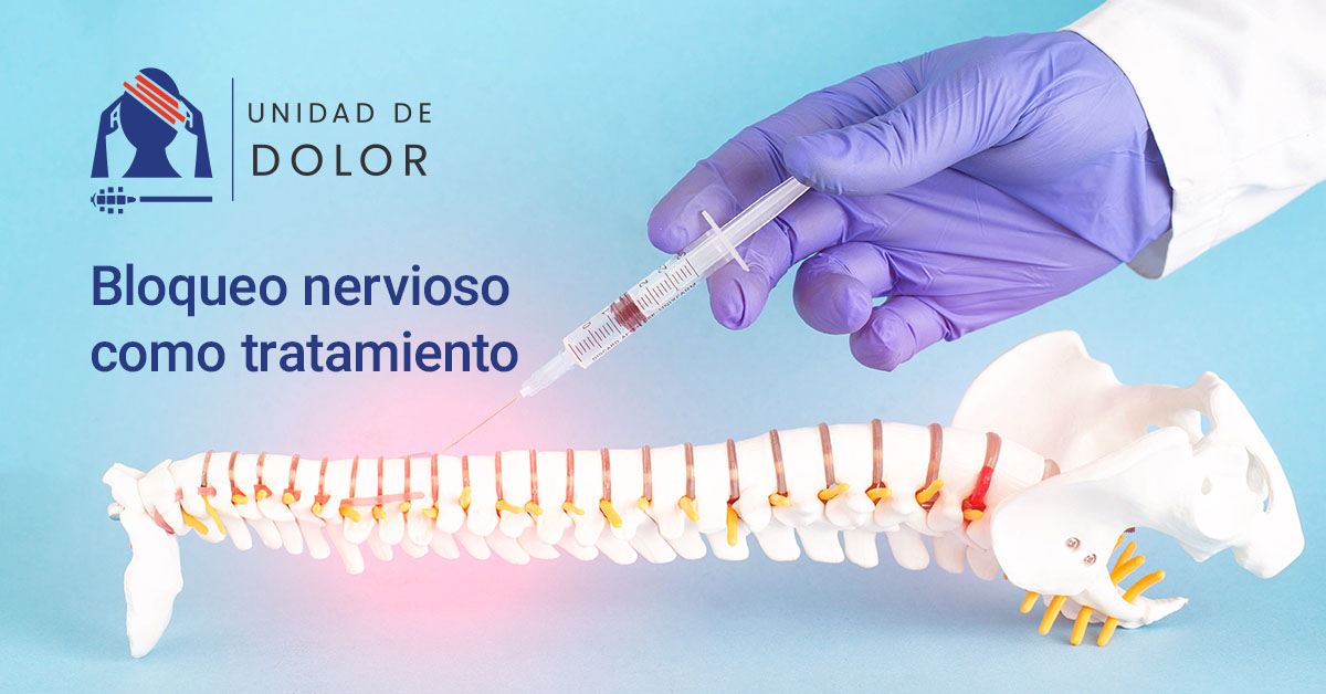 Bloqueo Nervioso para el Alivio del Dolor